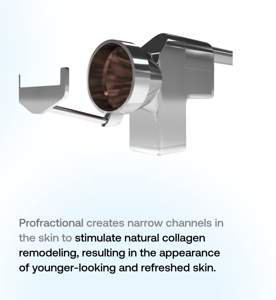 ProFractional Laser Treatment in Gig Harbor, WA