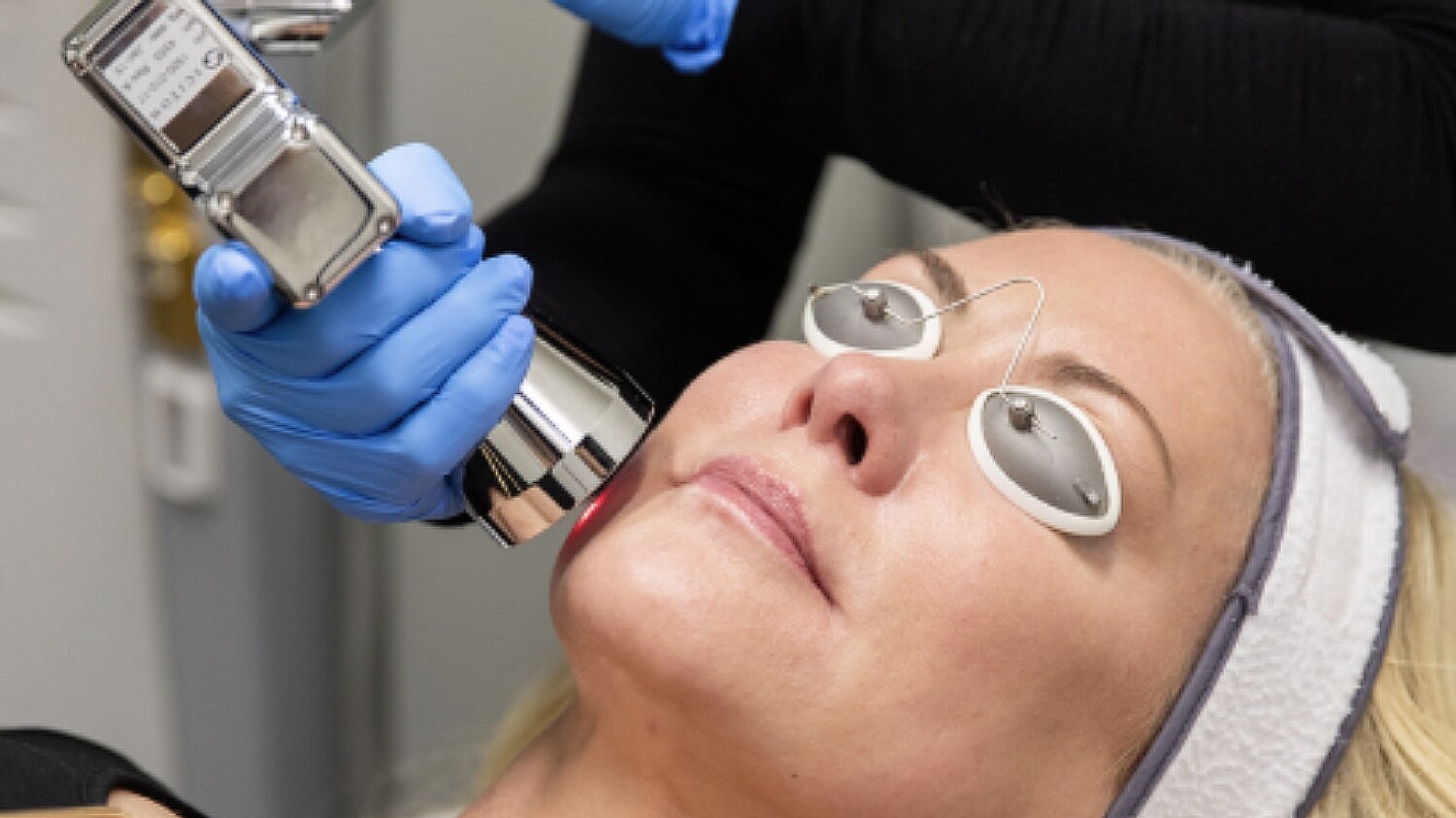 Best NanoLaser Peel Treatment in Gig Harbor, WA