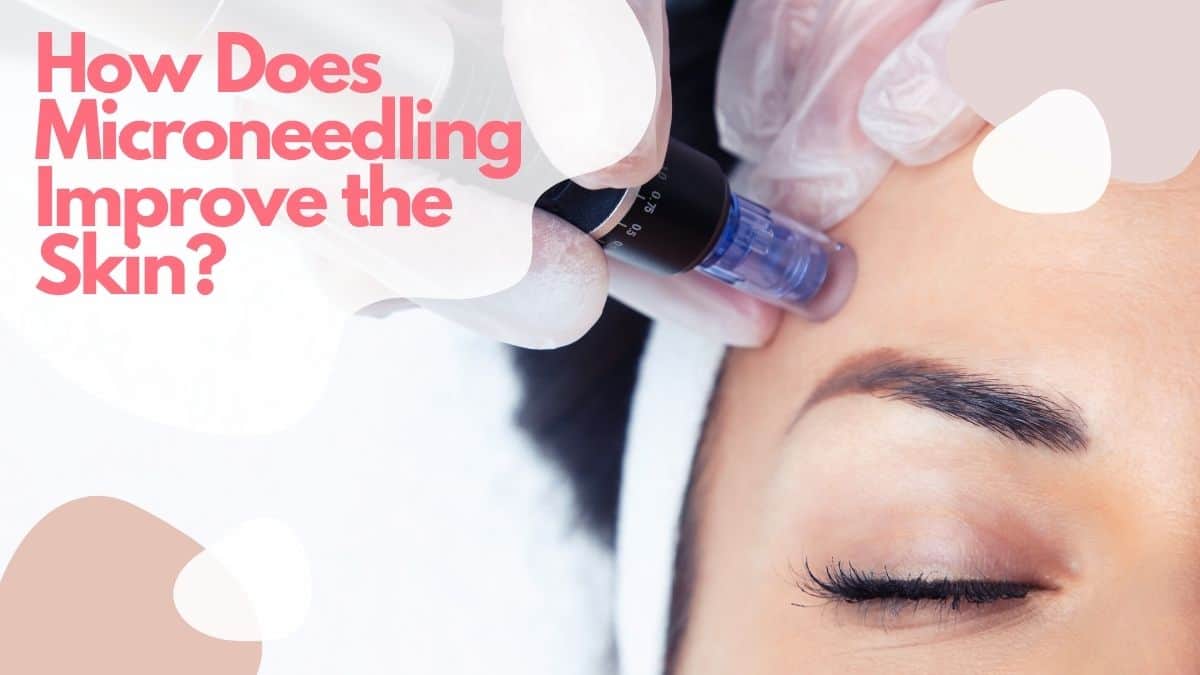 How Does Microneedling Improve the Skin?